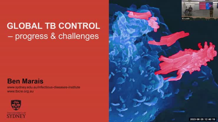 Global TB control – progress, challenges and a path for the Pacific