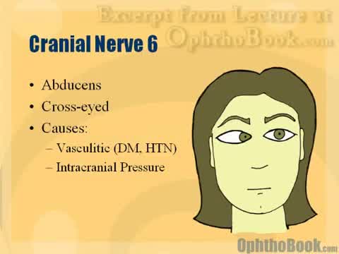 Cranial Nerve 6 palsy