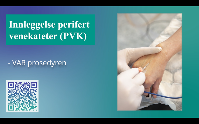 Film_01_Innleggelse_PVK_220920