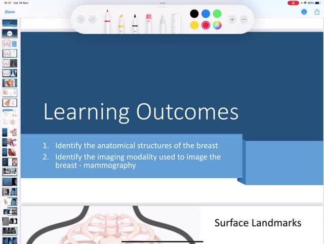 Breast Anatomy and Anatomical Structures on a mammogram (YM)