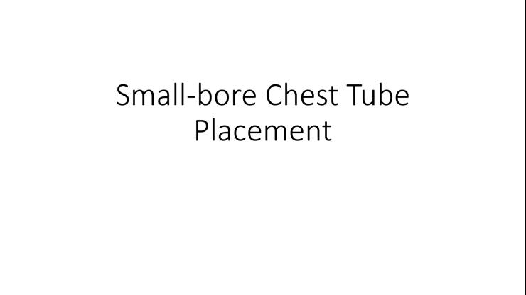 Small bore Chest tube placement