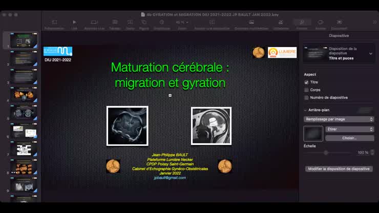 anomalie migration / gyration
