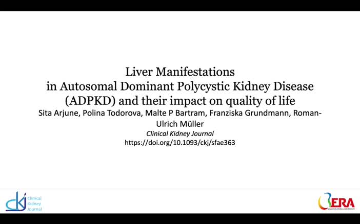 Liver Manifestations in Autosomal Dominant Polycystic Kidney Disease ...