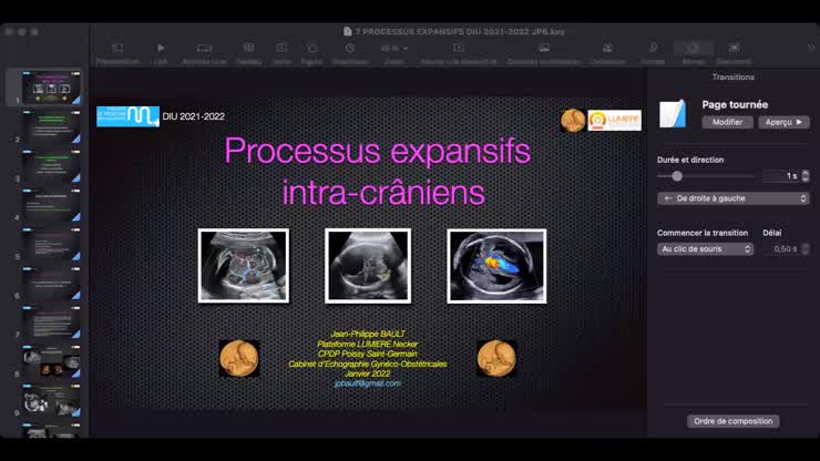 processus expansifs intra craniens