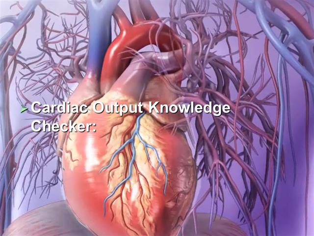 cardiac output knowledge checker