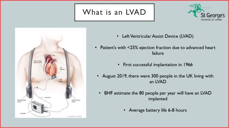 LVAD