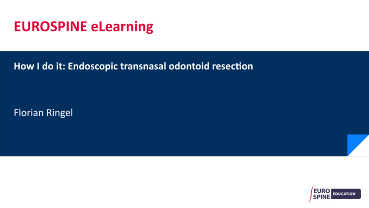 How do I do it - Endoscopic transnasal odontoid resection