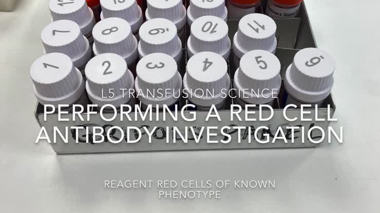 Antibody Investigation practical