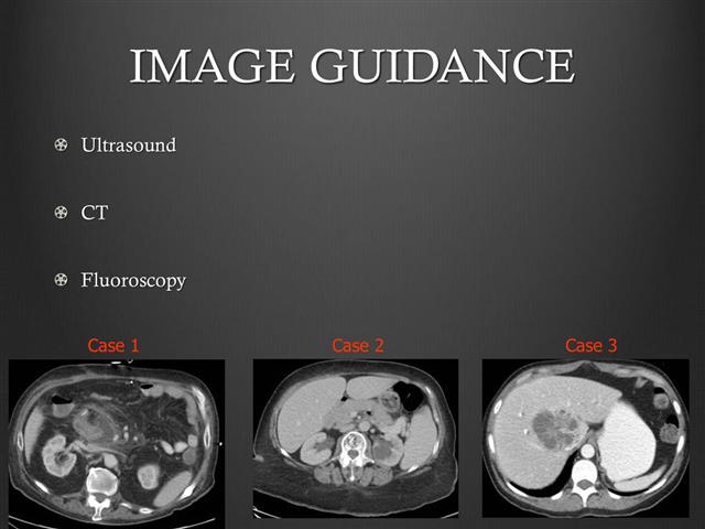 Fourth med Radiology Dr O'Connor part 2
