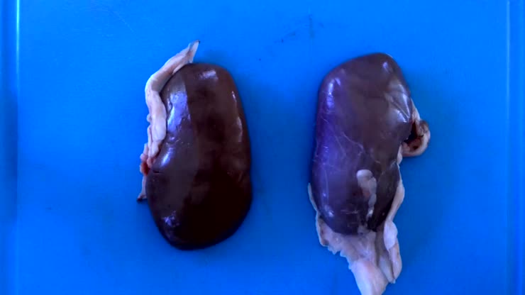 Kidney dissection